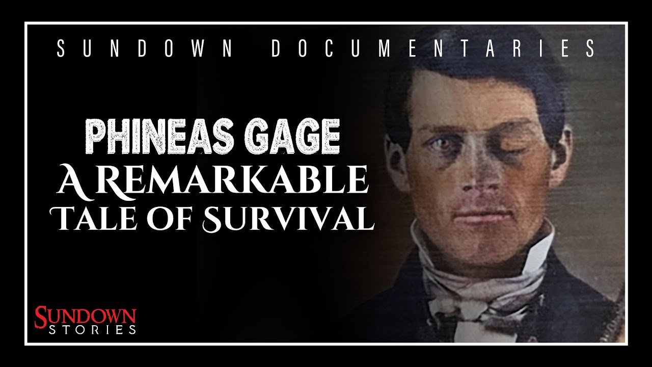 Phineas Gage: The Man Who Survived a Tamping Iron Through His Skull ...