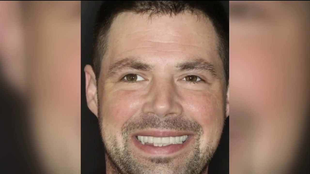 Man overcomes drug addiction finds his smile again with life changing ...