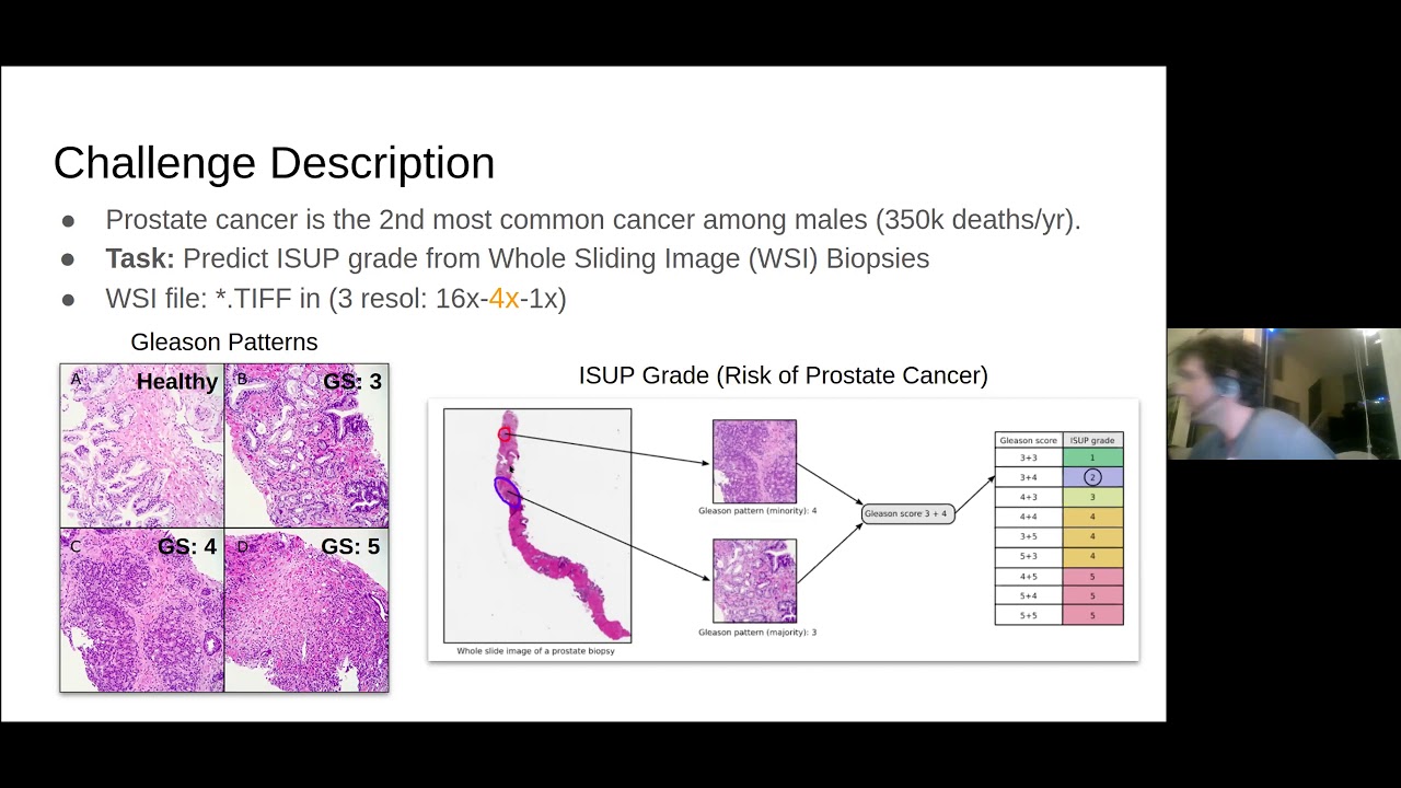Kaggle meetup: Prostate cANcer graDe Assessment (PANDA) Challenge - YouTube