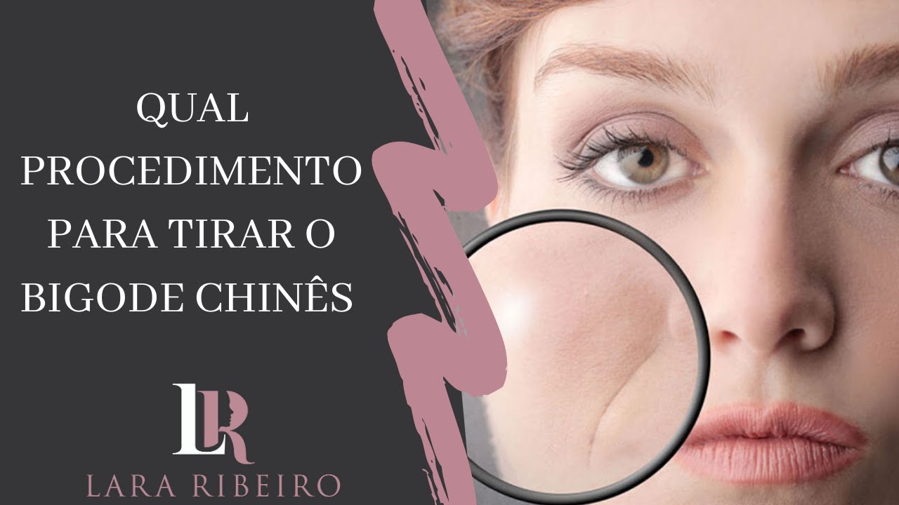 Qual procedimento para tirar o bigode chinês | Dra. Lara Ribeiro - YouTube