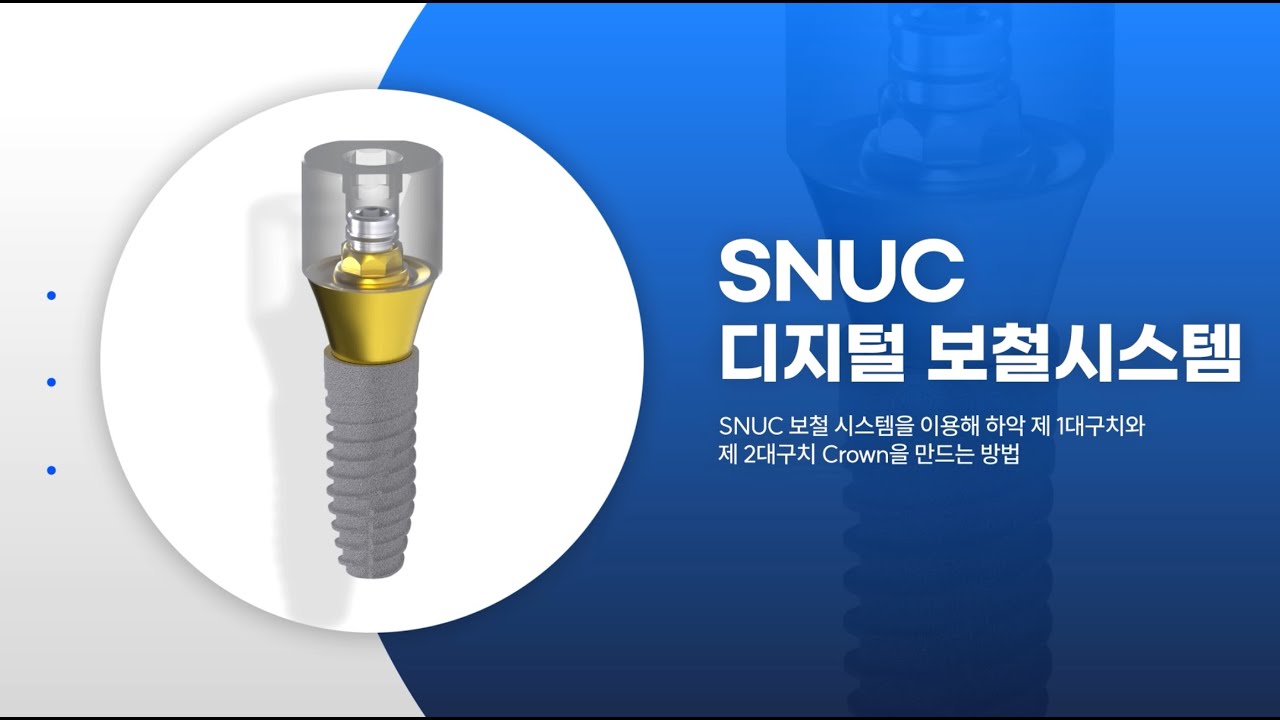 SNUC Prosthetic System SNUC디지털 보철 체결방법 - YouTube