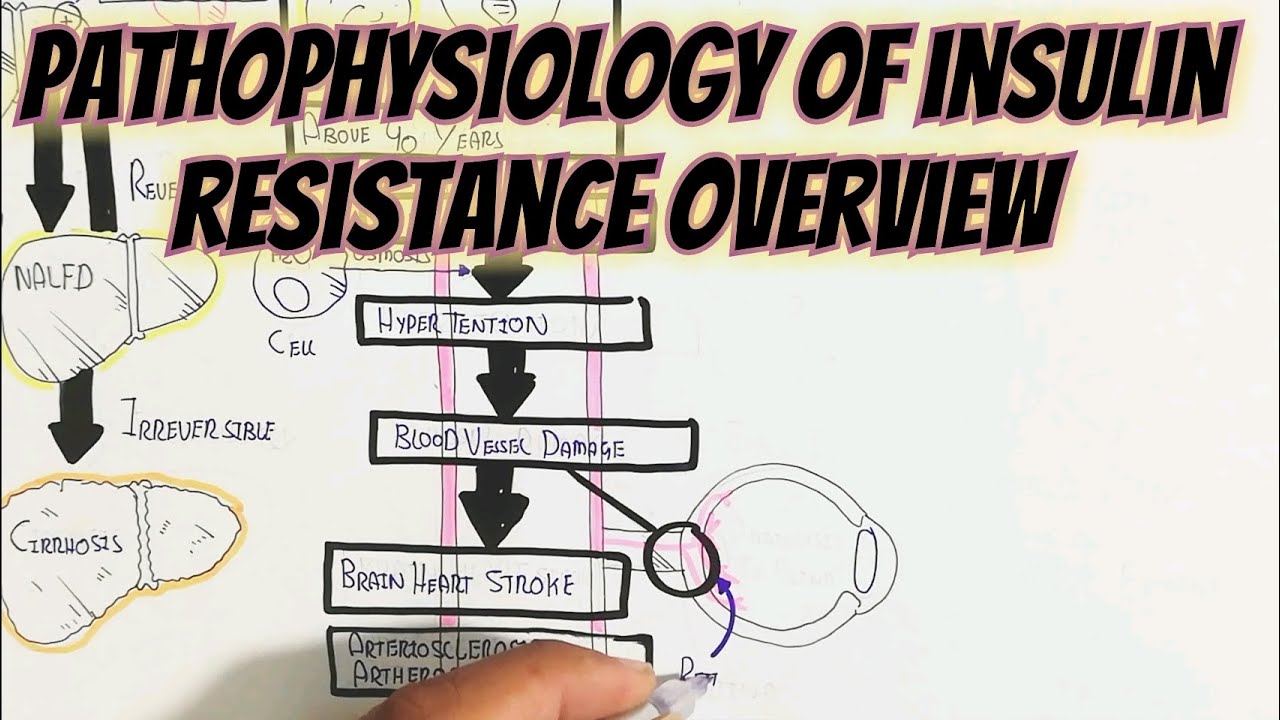 Insulin Resistance Pathophysiology(T2 Diabetes) @umerfarooqbiology7083 ...