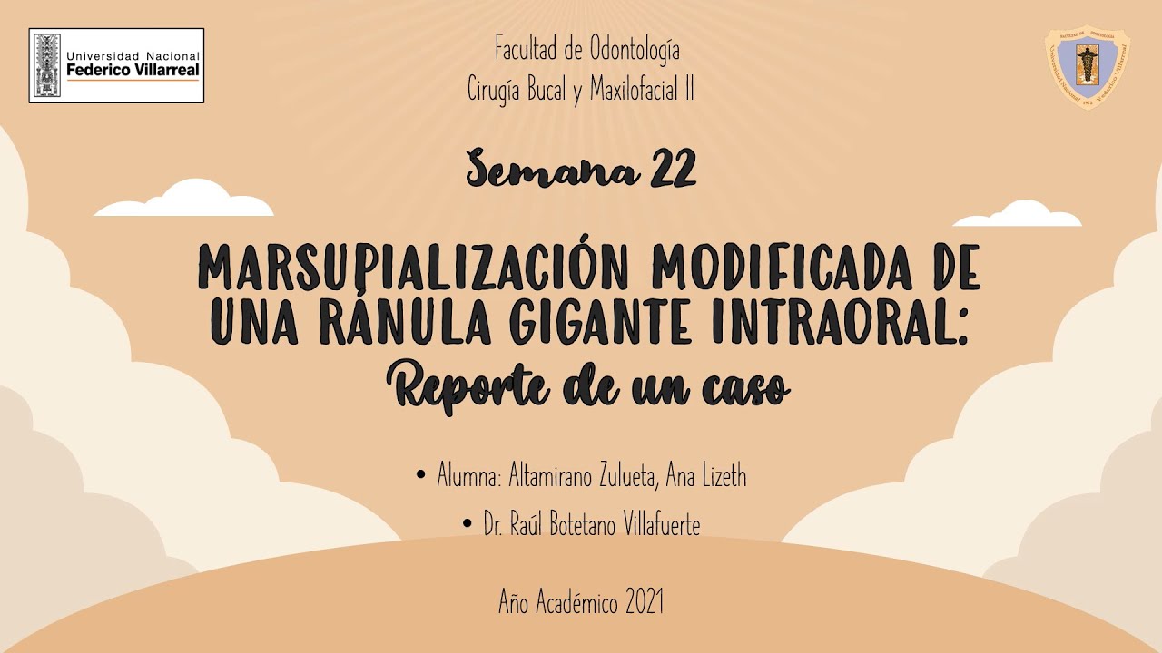 SEMANA 22: Marsupialización modificada de ránula gigante intraoral ...