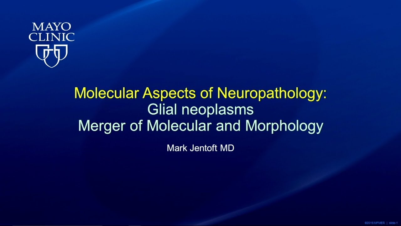 Glial Neoplasms Merger of Molecular Morphology by Mark E. Jentoft, MD ...