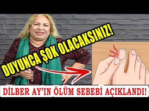 Dilber Ay'ın Ölümüne Sebep Olan Dikkatsizlik!