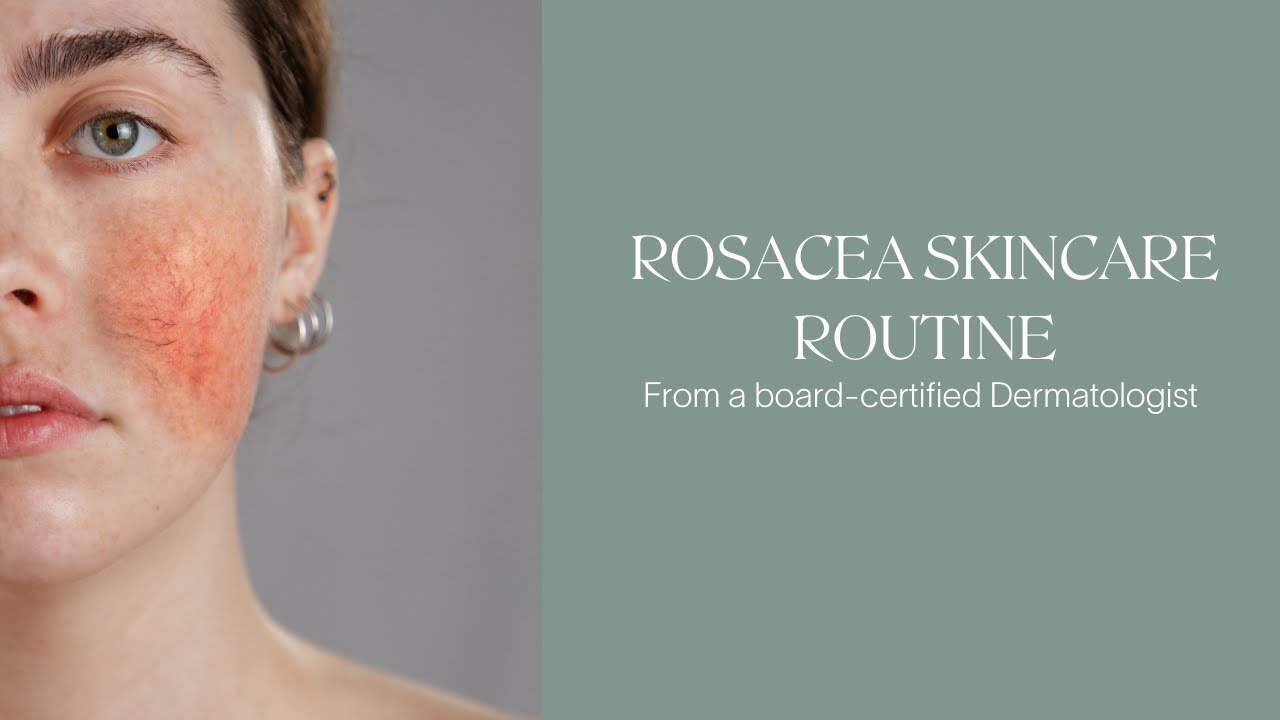 DERM EXPLAINS: Skincare Routine for Rosacea - YouTube