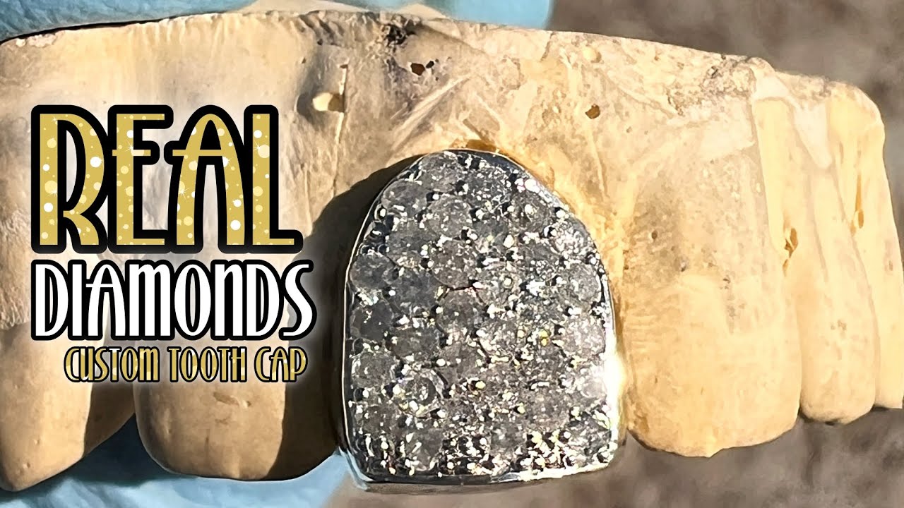 Natural Diamonds 925 Sterling Silver Single Tooth Cap Custom Fitted ...