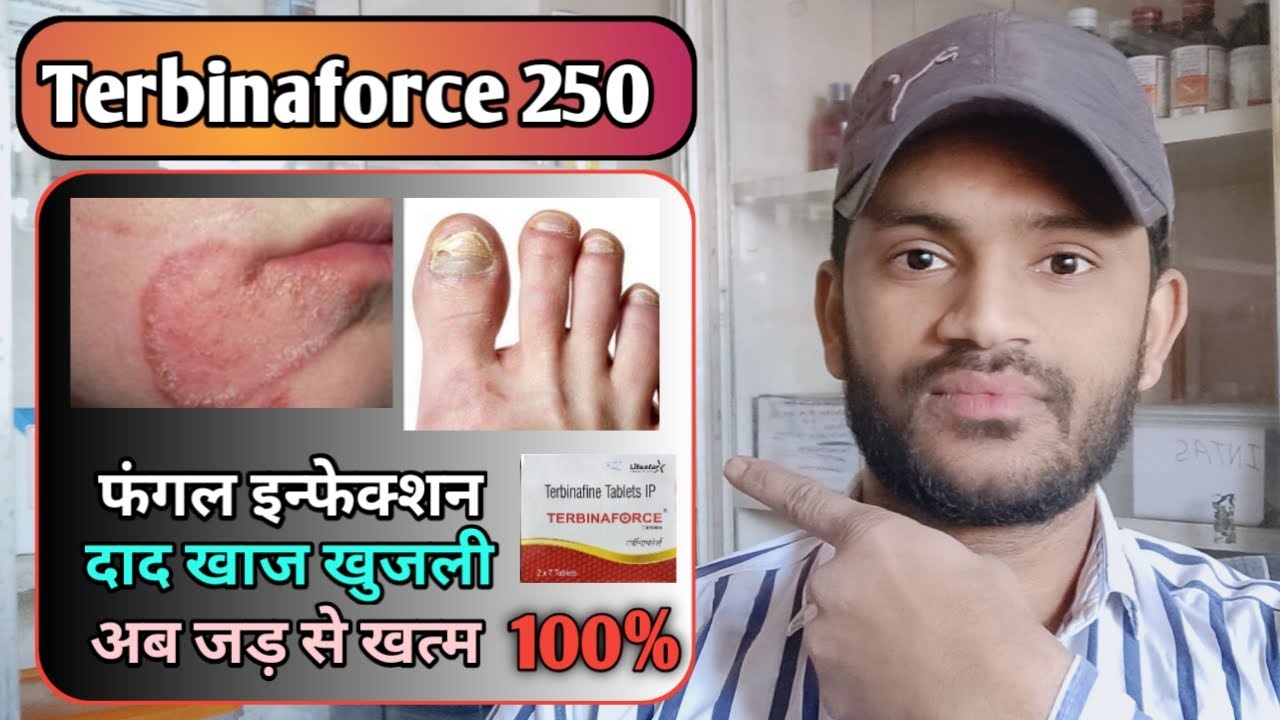 Terbinaforce 250 tablet use dose benefits and side effects full review ...