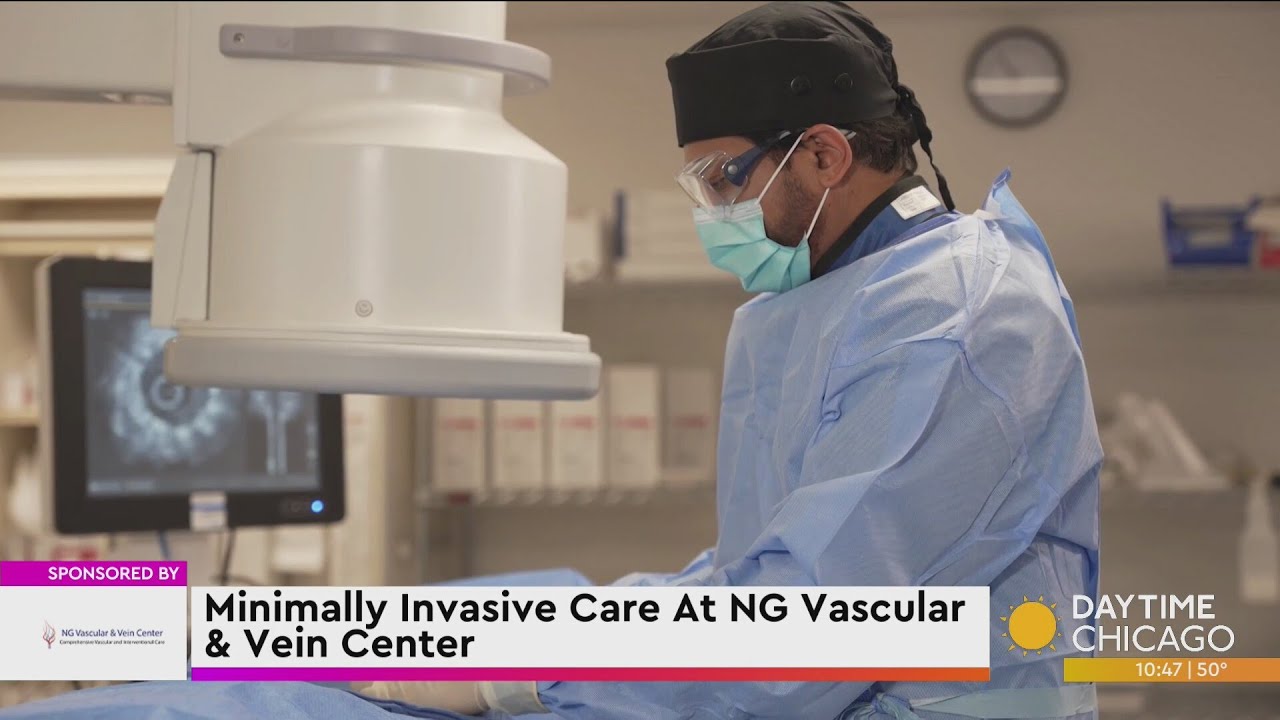 Minimally Invasive Care At NG Vascular & Vein Center - YouTube