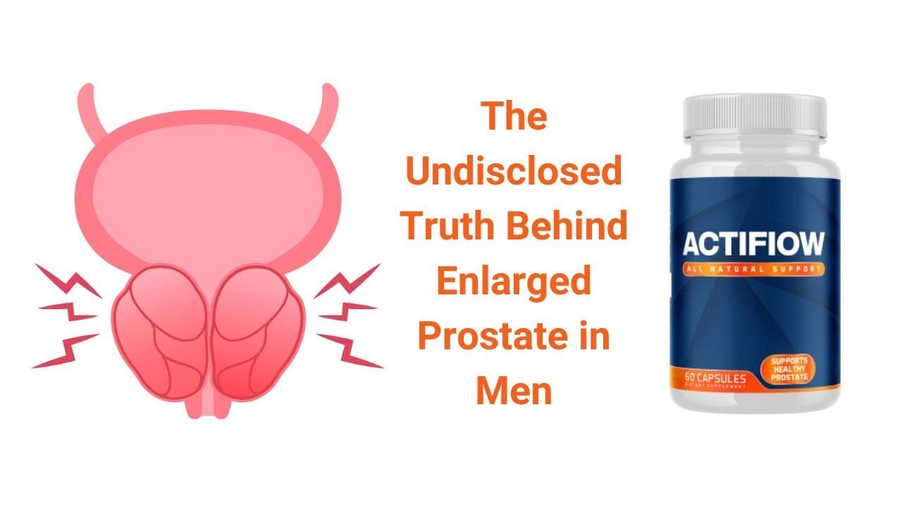 Actiflow Supplement Review | Weak Urine Flow? Do This For A Healthy ...