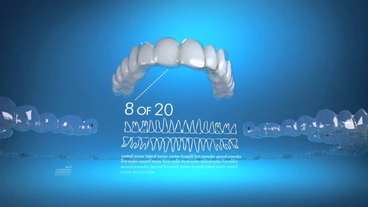 Invisalign How it Works from Dr Terry Hopper DMD - YouTube
