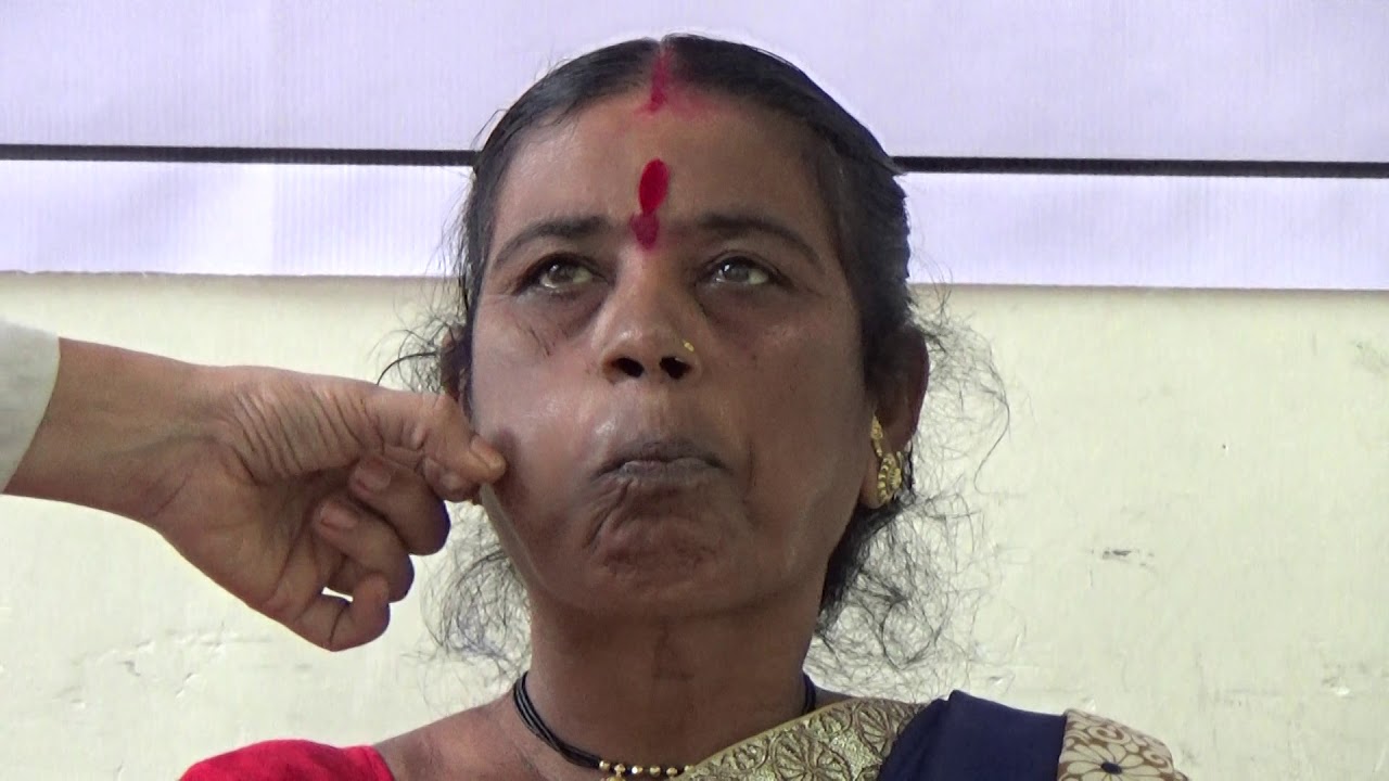 Cranial nerve VII -facial nerve testing for muscles of expression - YouTube