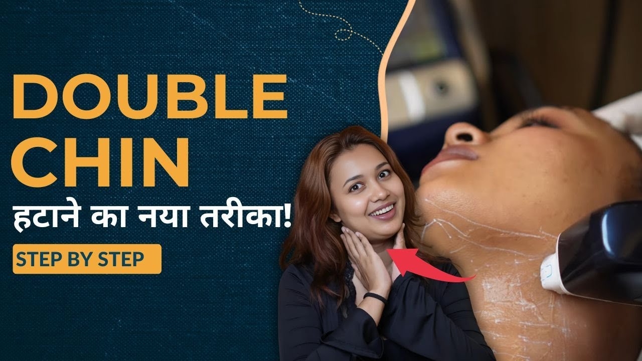 Double Chin Removal using HIFU Treatment | Step by Step | Ft. Roseline ...