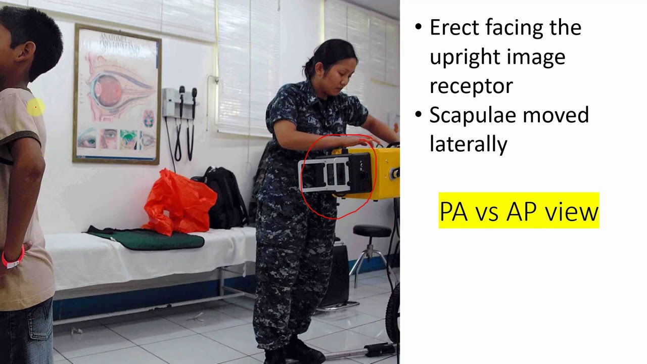 AF SOMALI CHEST X RAY CASHARKA 1 aad - YouTube