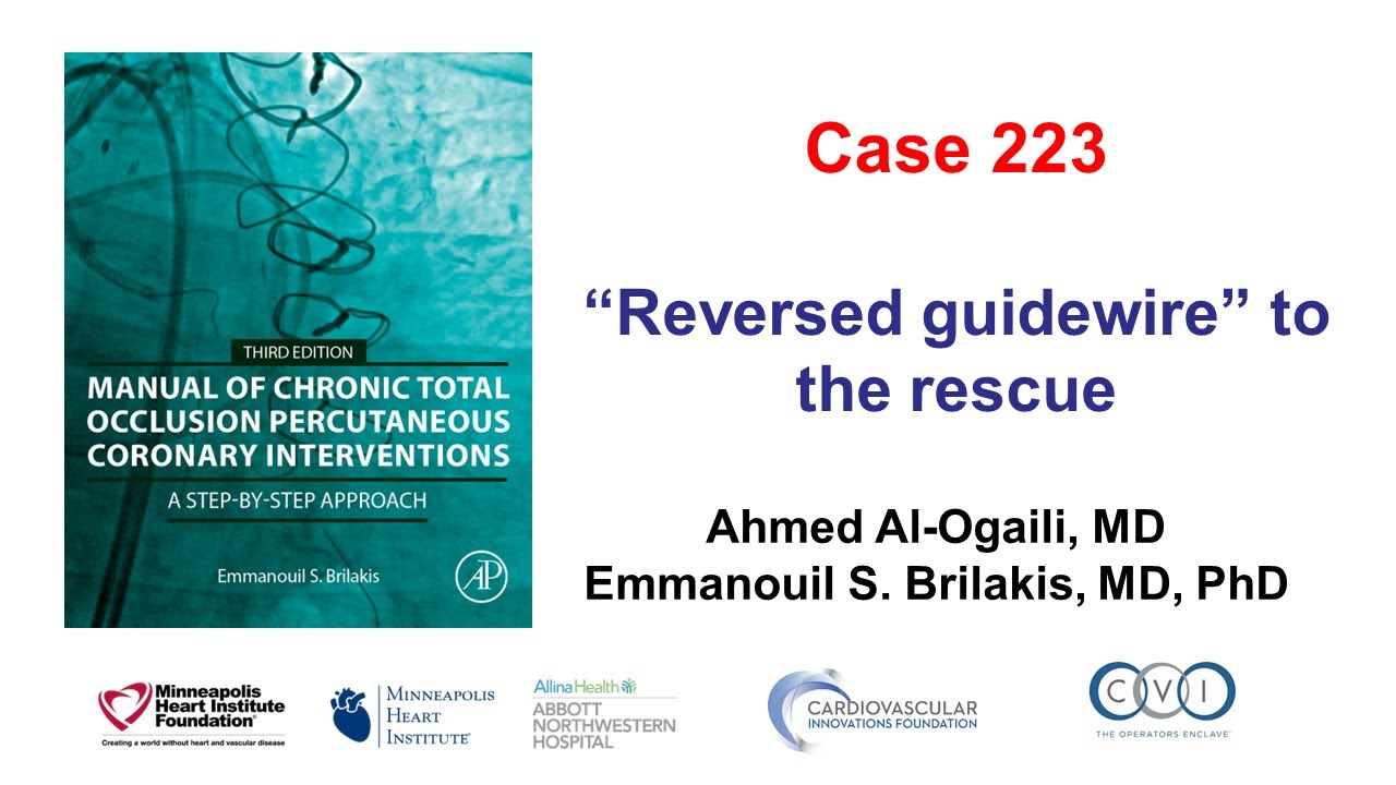 Case 223: Manual of CTO PCI - Reversed guidewire to the rescue - YouTube