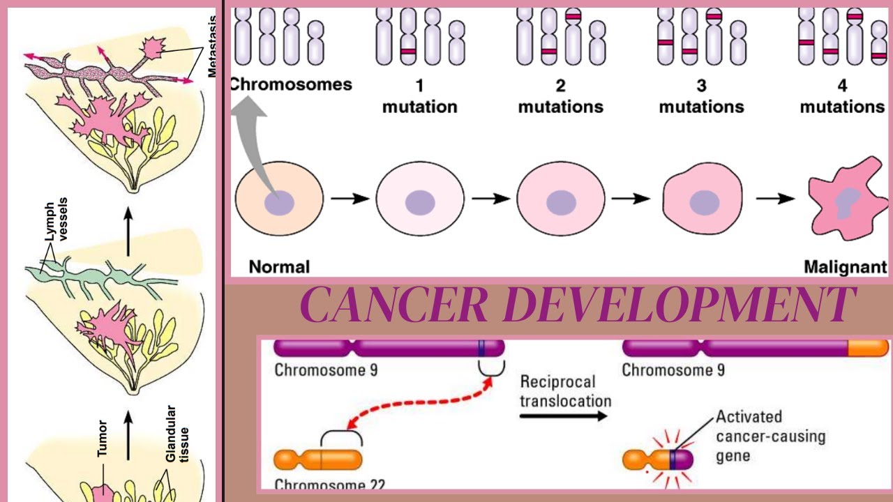 Introduction to Cancer Biology (Part 2): Tissue Invasion and Metastasis ...