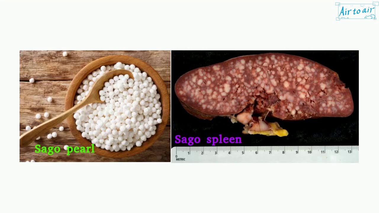 [ Krok 1 Medicine ] Year: 2017 - 040 (Ministry of Public Health of ...