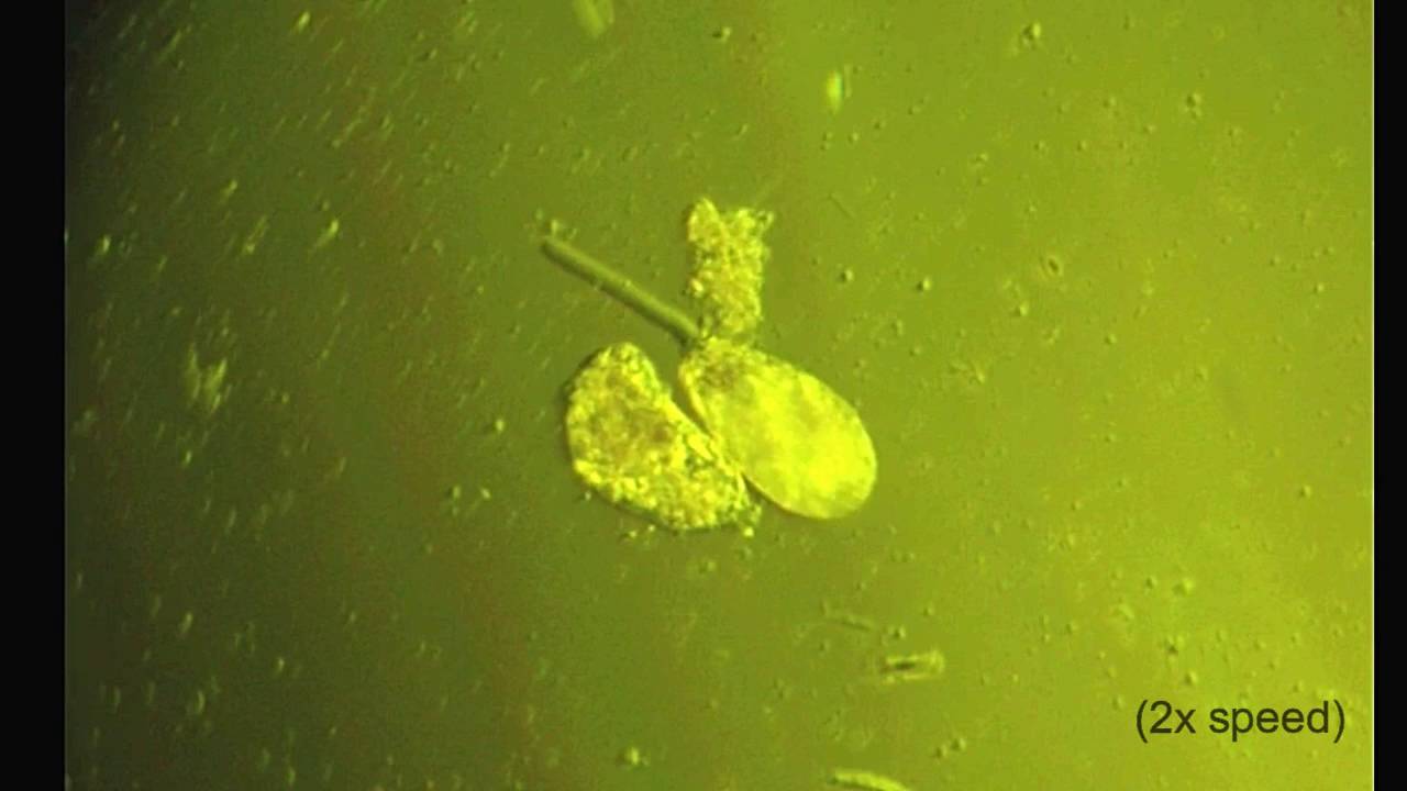 difflugia & two (naked) amoebas - YouTube