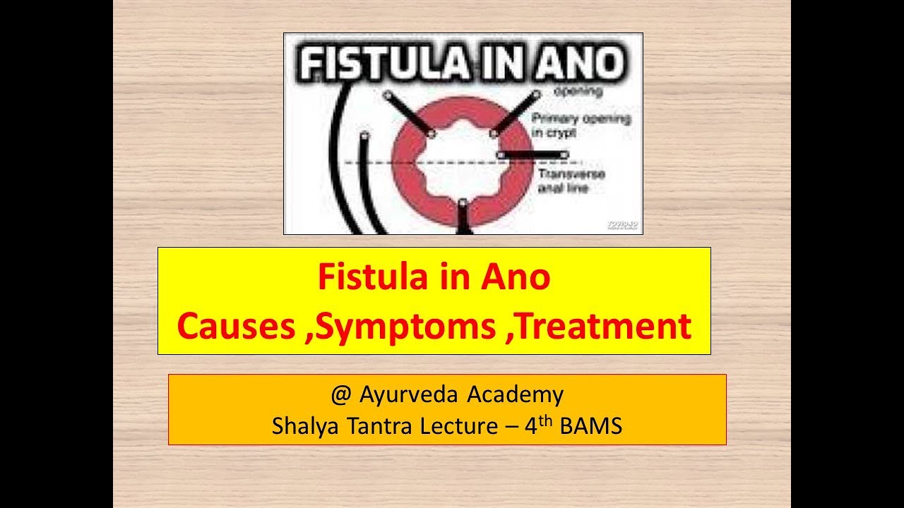 Fistula in Ano l Anal Fistula Symptoms & Treatment l Ayurvedic ...