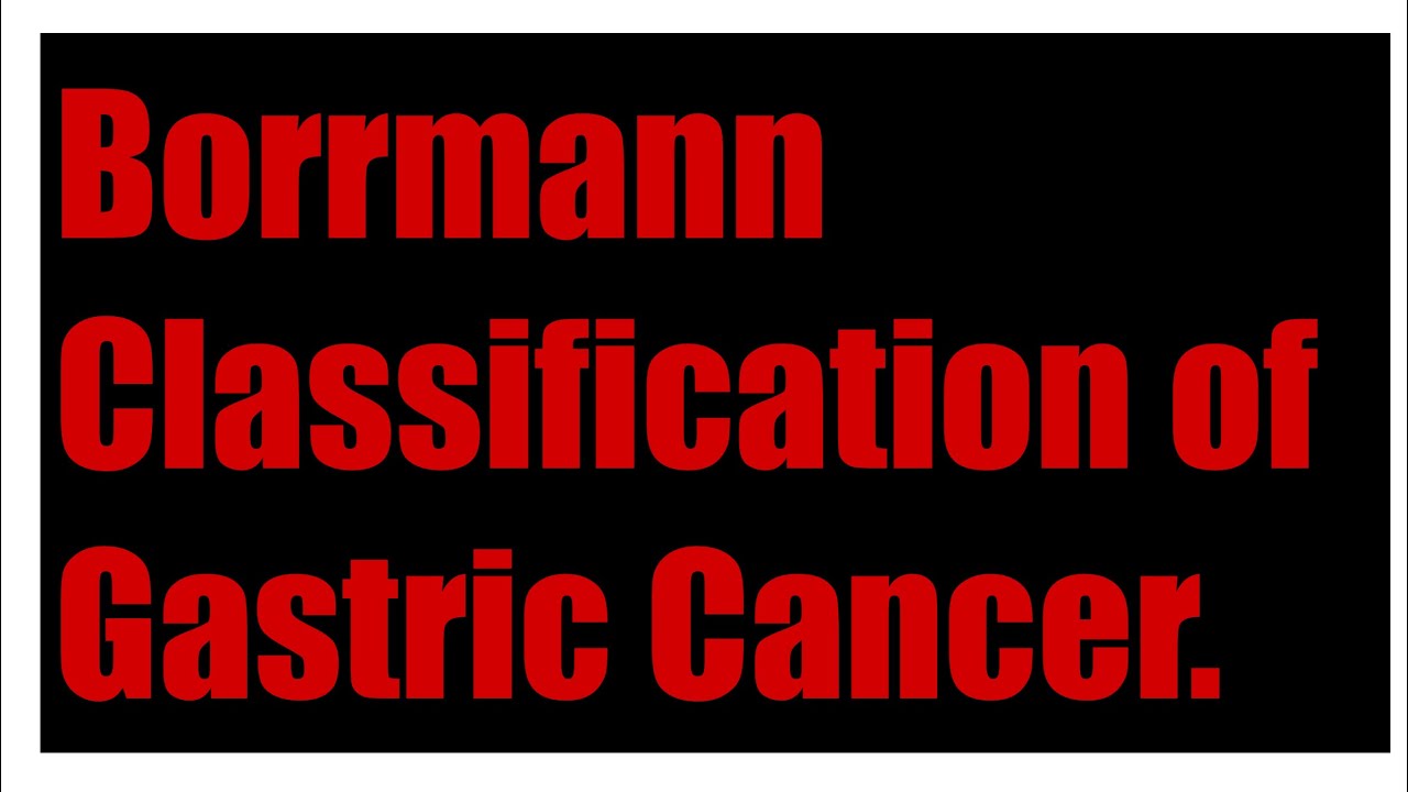 Borrmann Classification of Gastric Cancer based on Gross Appearance ...