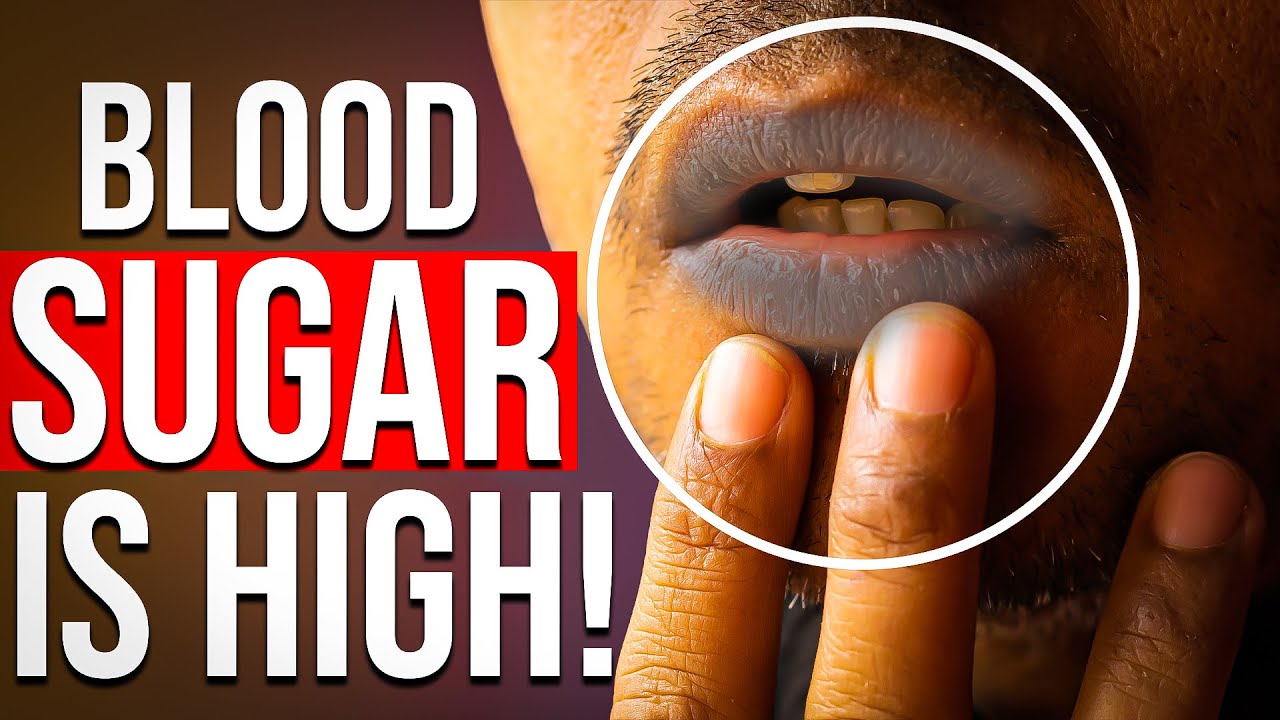 Signs Your Blood Sugar Is High & Early Symptoms - YouTube