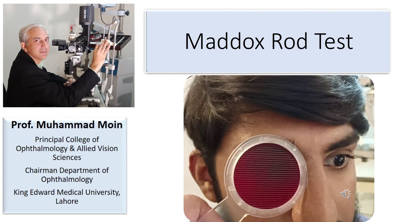 Maddox Rod Test - YouTube
