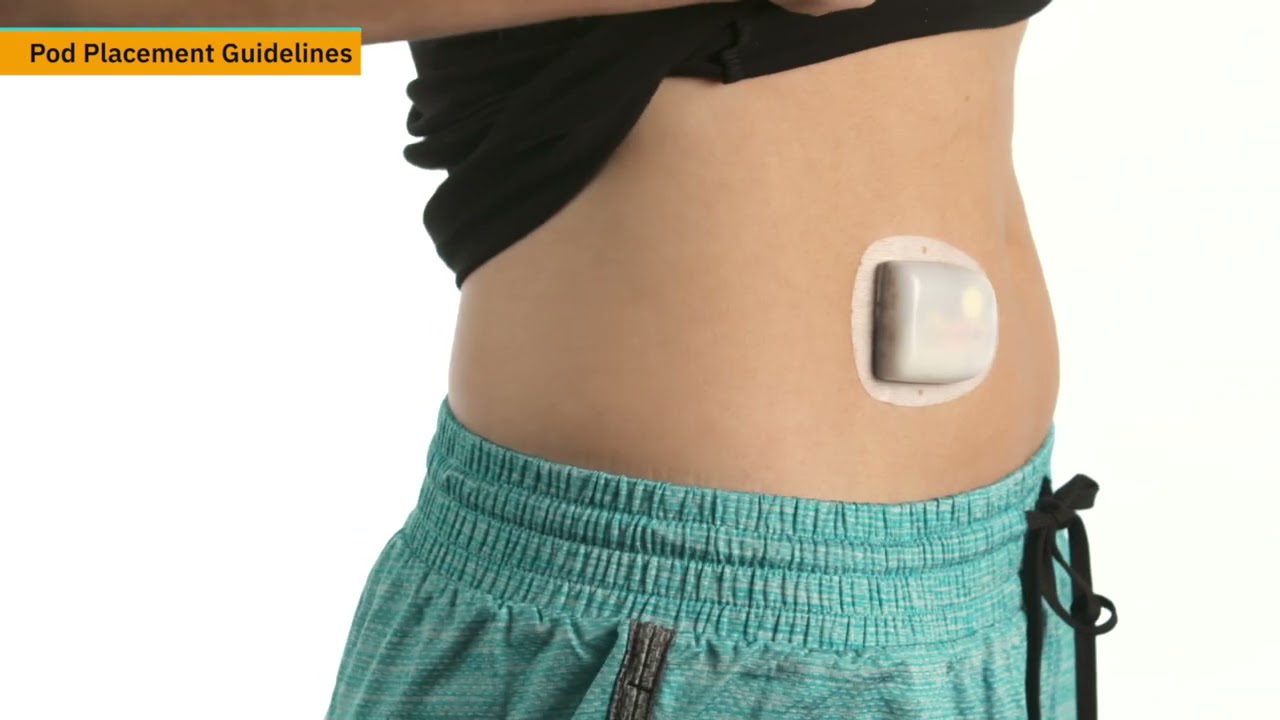 Omnipod Insulin Pump