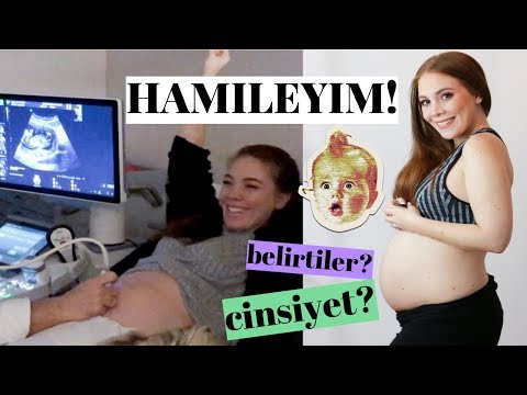 HAMİLEYİM 😍 Cinsiyet, Hamilelik Belirtileri, 1.Trimester, Detaylı Ultrason 💕