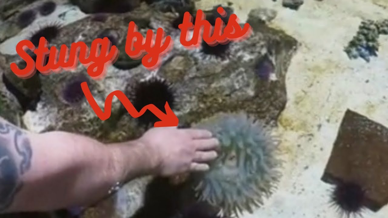 Getting Stung by Anemone, Petting Sea Urchin and Starfish When We Visit ...