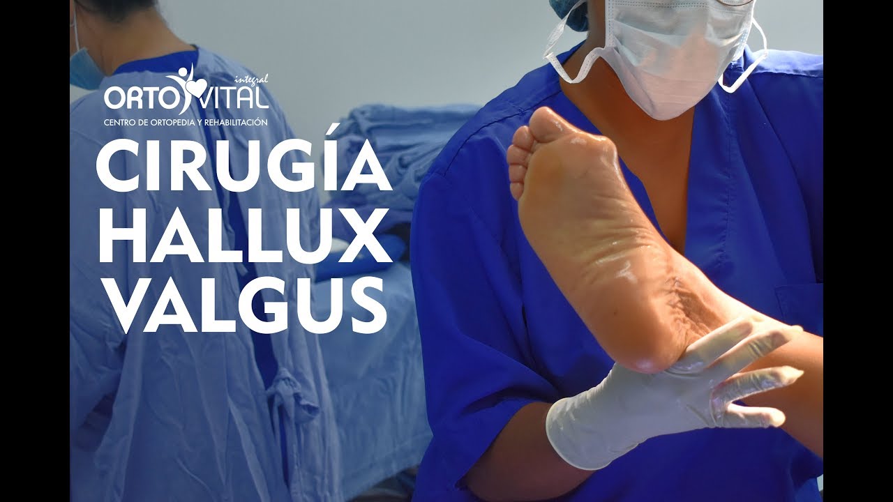 CIRUGÍA HALLUX VALGUS - YouTube