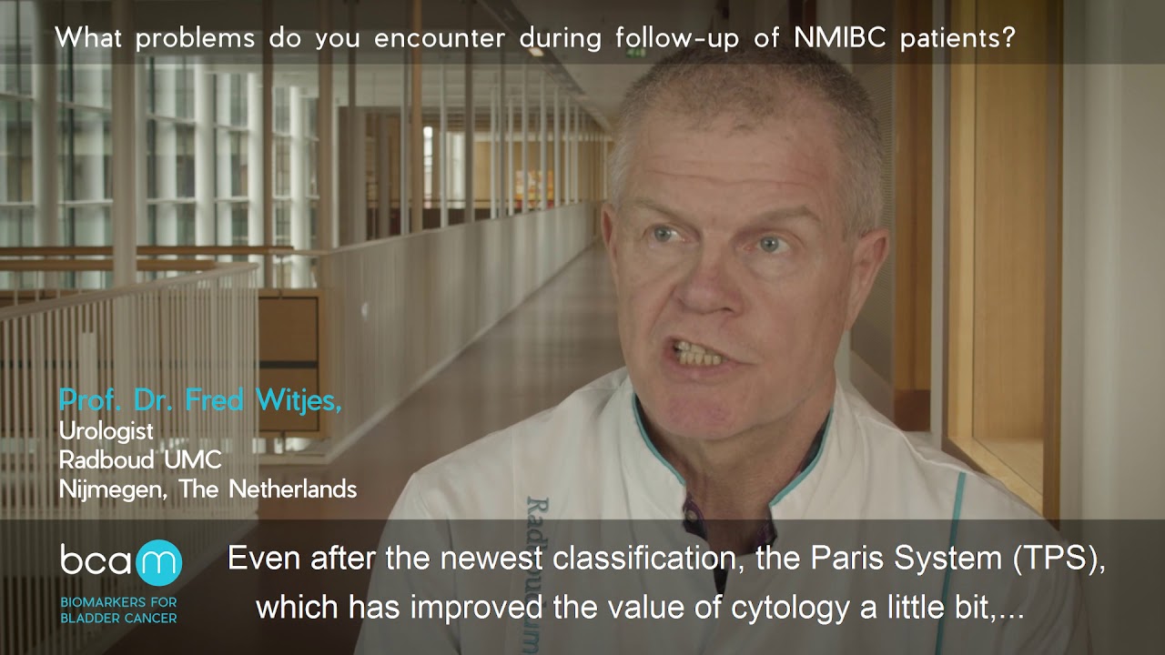 The burden of non-muscle invasive bladder cancer (NMIBC) surveillance ...