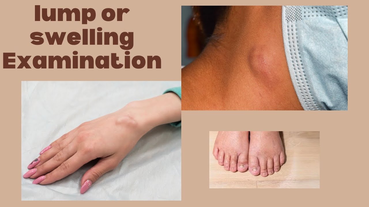 Surgery | Examinations in Surgery: Detailed Approach to the Examination ...