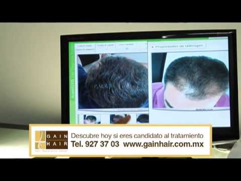 Gain Hair - Descubre hoy si eres candidato al tratamiento
