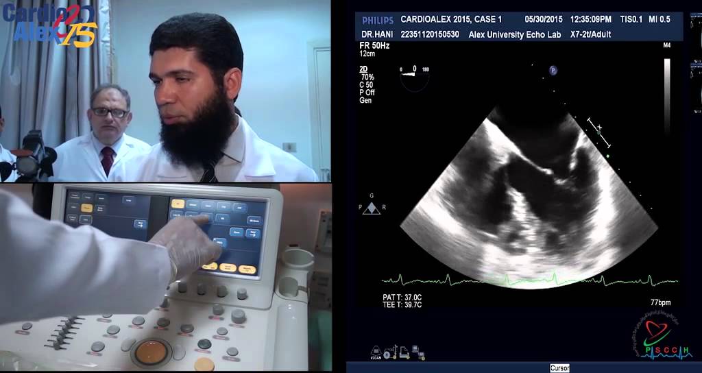 How to perform 3D-TEE exam "a step by step approach" - YouTube
