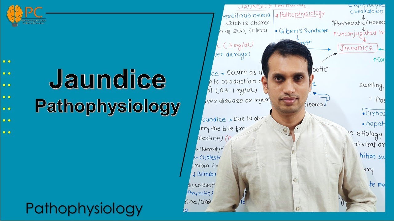 Jaundice Pathophysiology and Treatments - YouTube