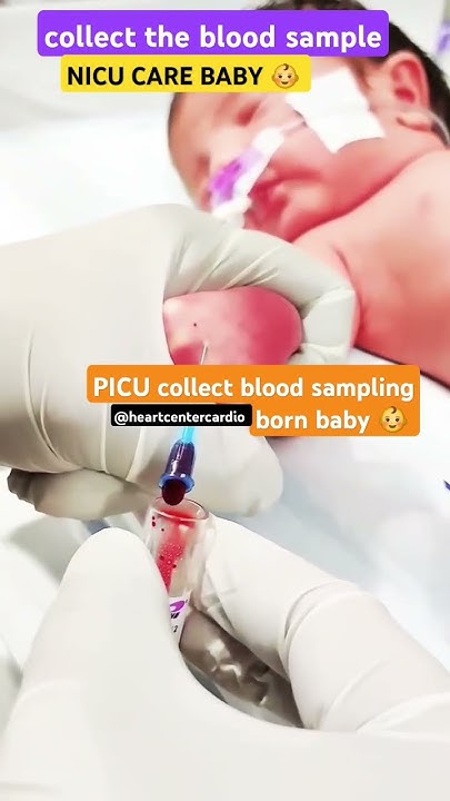 PICU collect blood sampling born baby #video #doctor #nicu #picu#doctor #hospital #viralvideo ...