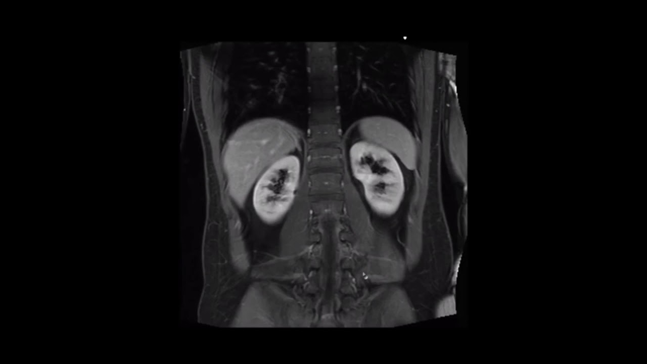 PROTOCOLO RM ABDOMEN ESTANDAR - YouTube