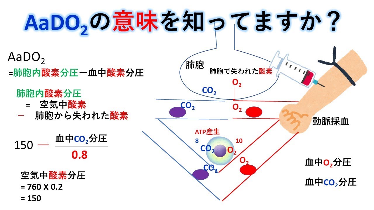 国試対策：暗記からの卒業 37話 AaDO2（肺胞気ー動脈酸素分圧拡差） - YouTube
