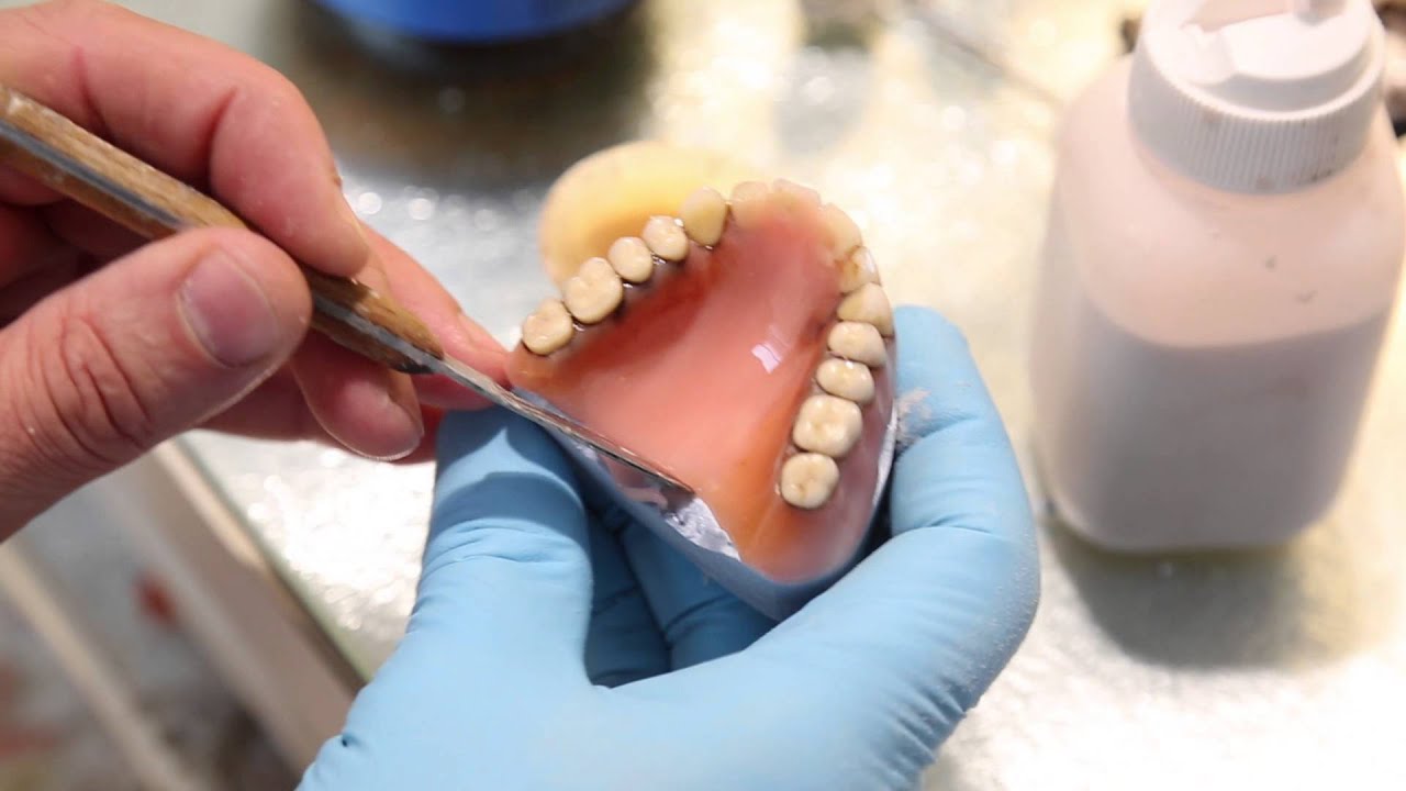 Herstelling Kunstgebit in 1uur - YouTube