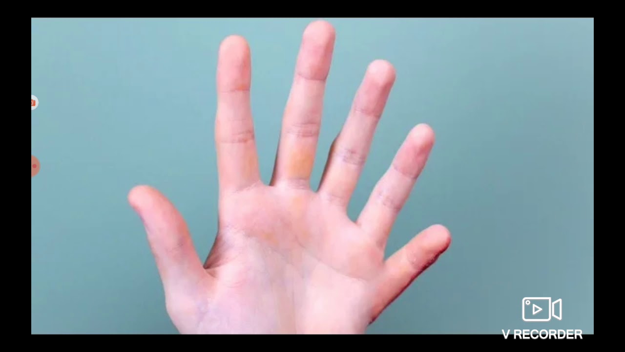 reacting to Jesse and Mike: six fingers on hand - YouTube