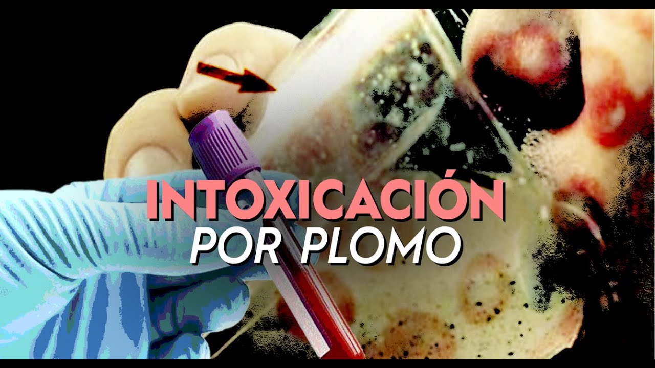 Intoxicación por Plomo - Farmacia y Bioquímica - UNT - YouTube