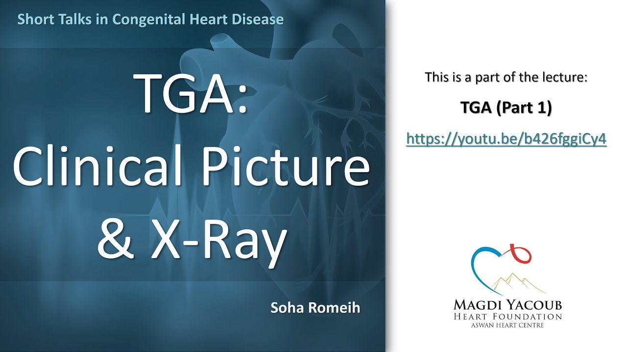 TGA: Clinical Picture and X ray - Soha Romeih - YouTube
