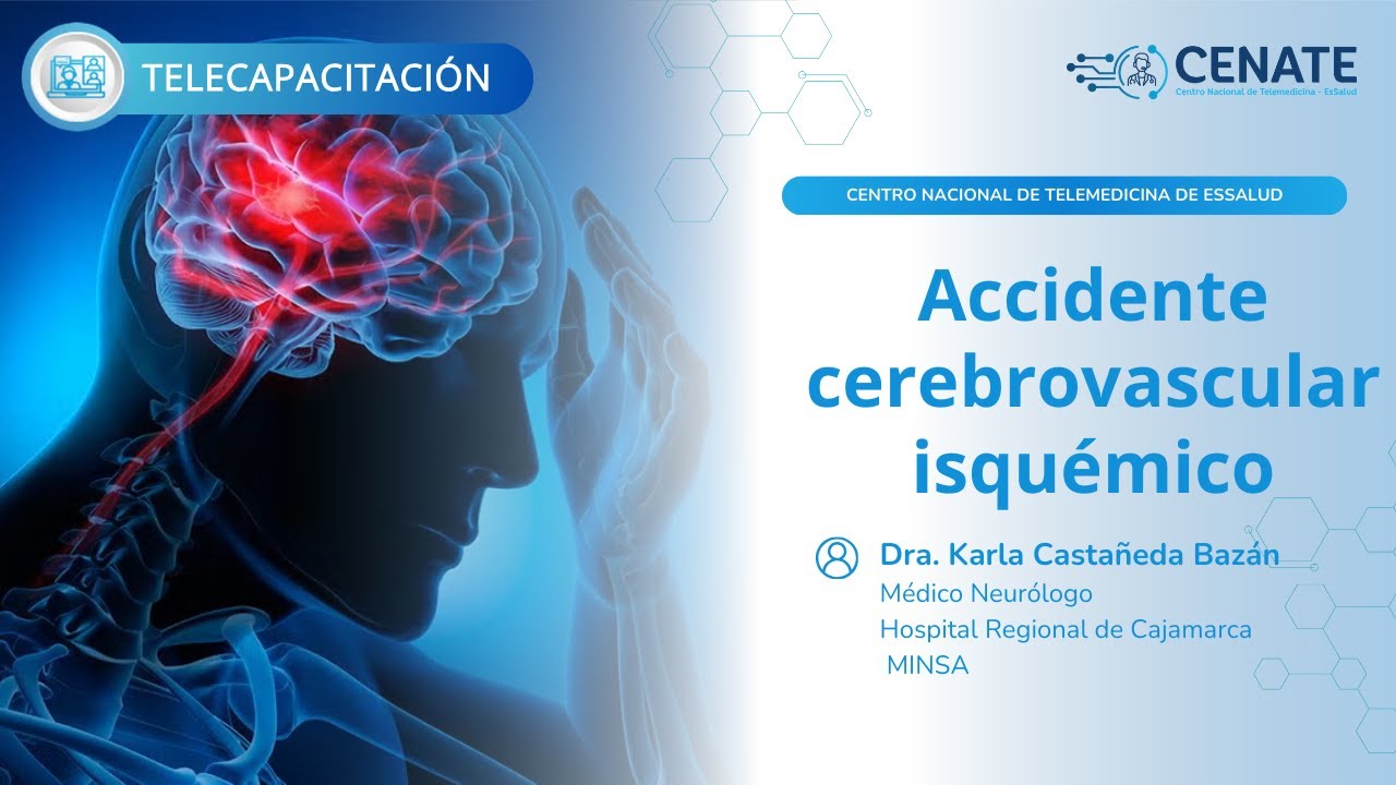 Accidente Cerebrovascular Isquémico Cerebral Ictus O Accidente