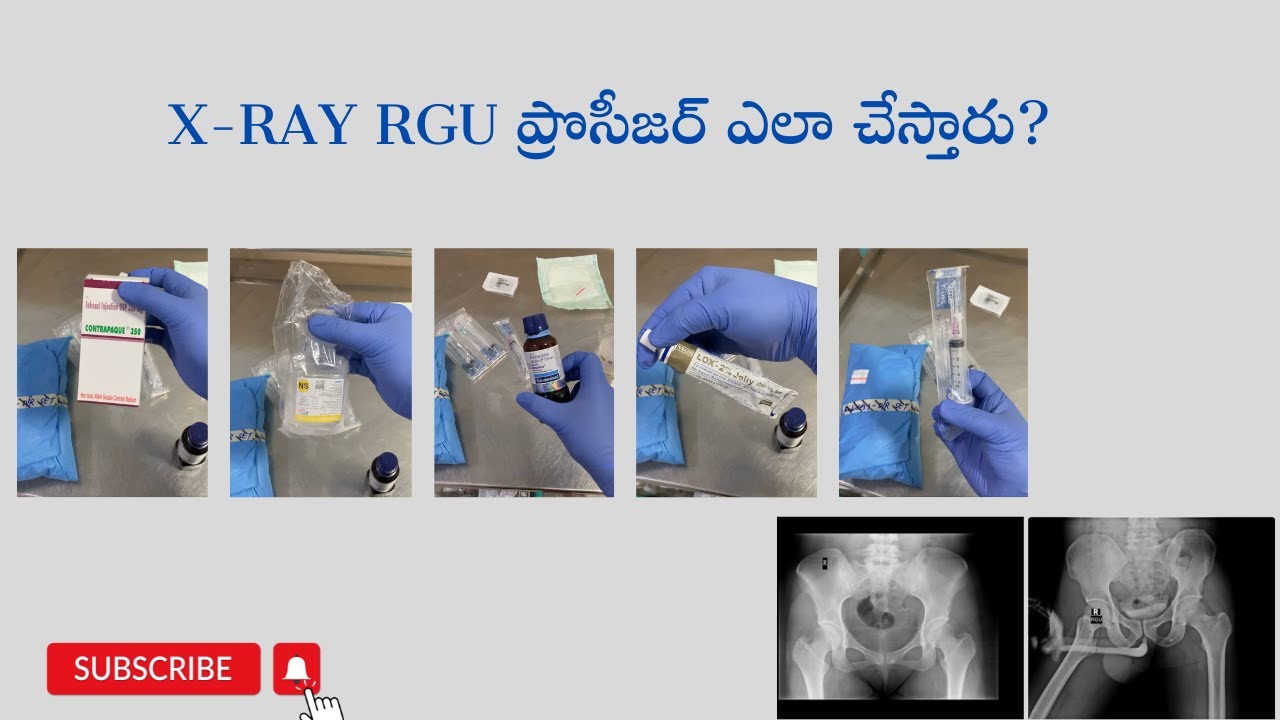 How to do X Ray RGU procedure #rgu #xray #xrays @xrayrgu #rgv #mcug # ...