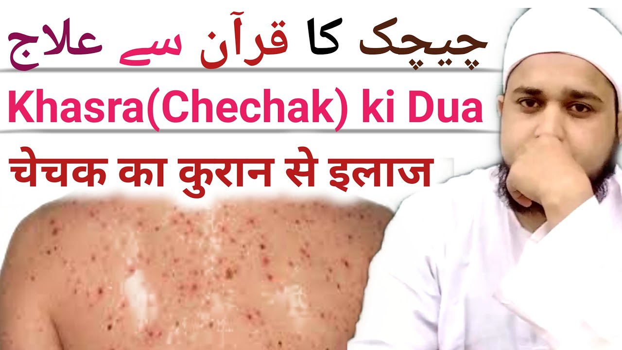 Khasra ki dua | chechak ka wazifa || chechak ki dua | chechak ka ilaj ...