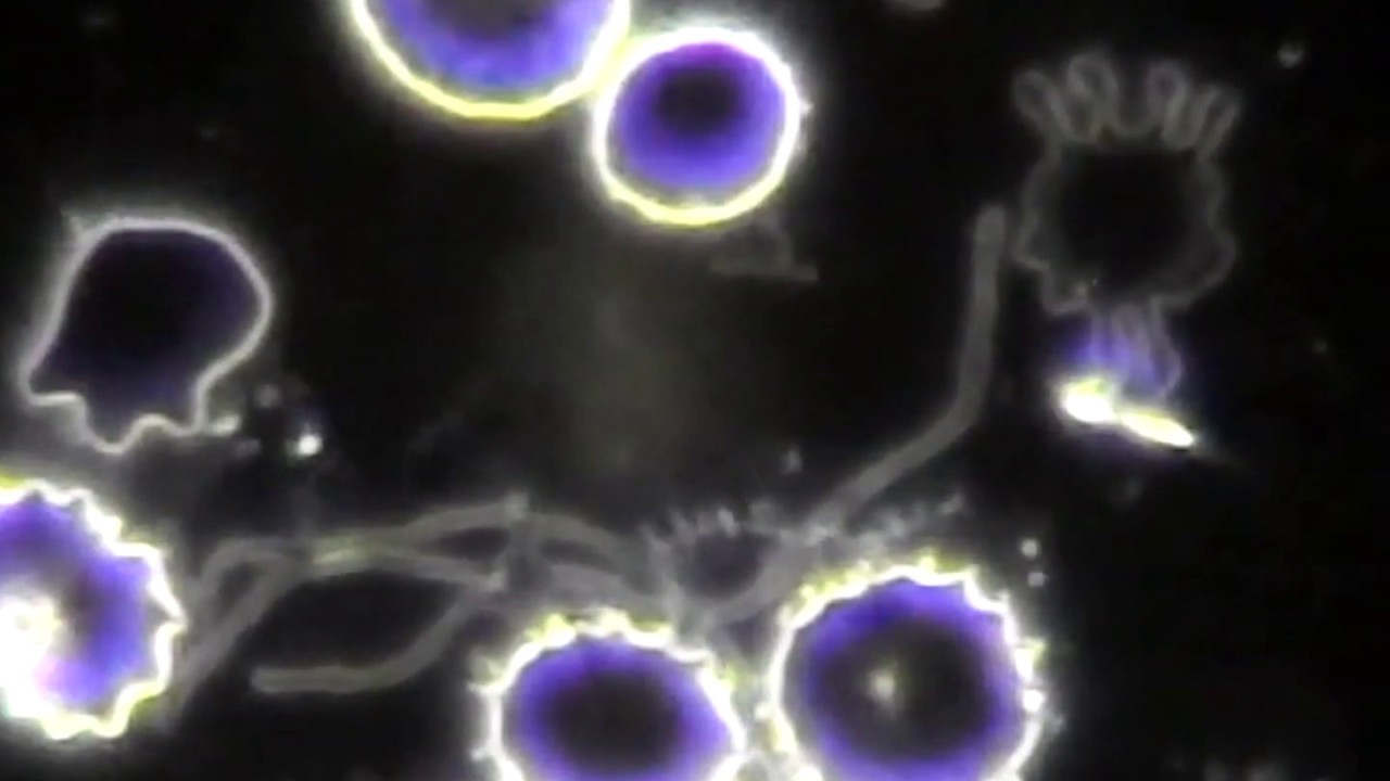 BLOOD TES- DARKFIELD MICROSCOPY: BORRELIA BURGDORFERI (mutant variety ...