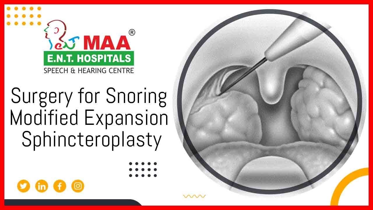 Surgery for Snoring Modified Expansion Sphincteroplasty - YouTube