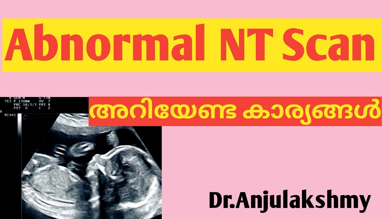 Abnormal NT Scan/Malayalam/Dr.Anjulakshmy - YouTube