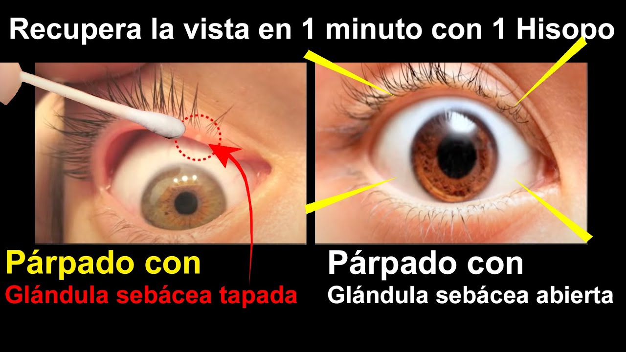 Como recuperar la vista con 1 solo Hisopo - YouTube