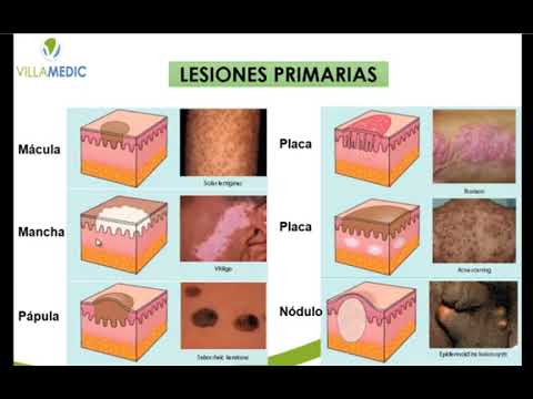 VILLAMEDIC - GENERALIDADES EN DERMATOLOGIA - YouTube